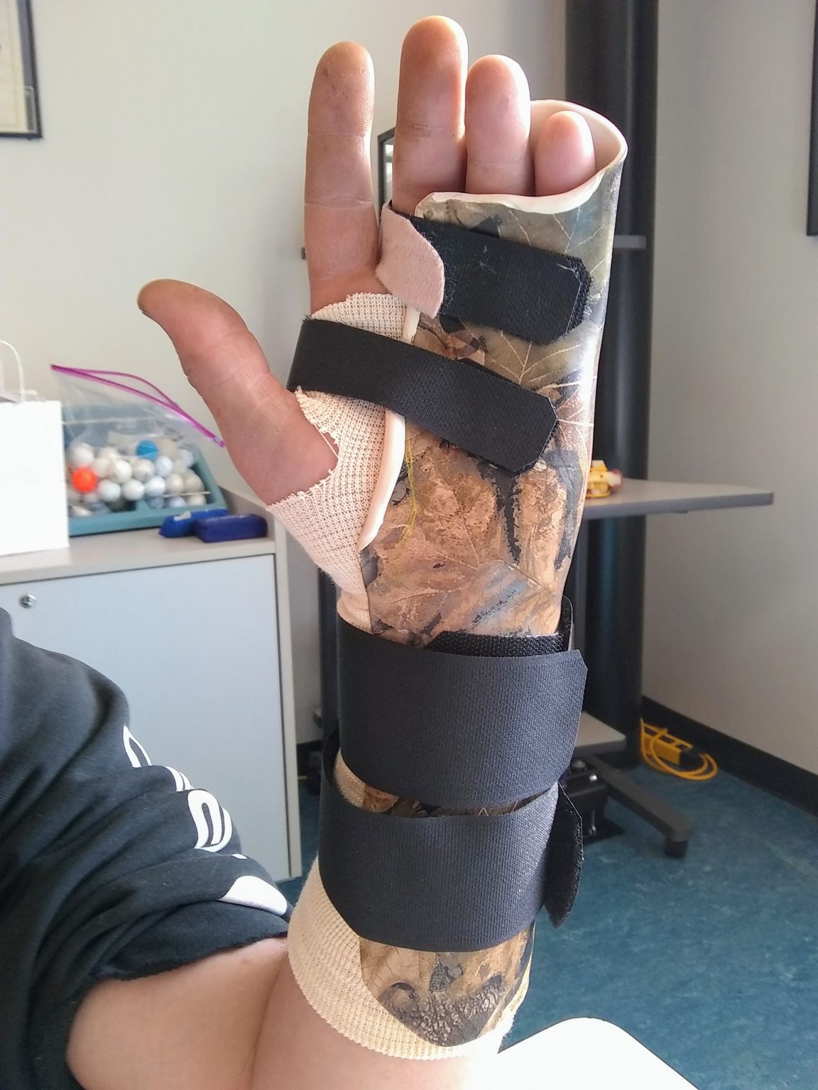 Fabricated Custom Orthotics - Orthopedic Rehab Specialists